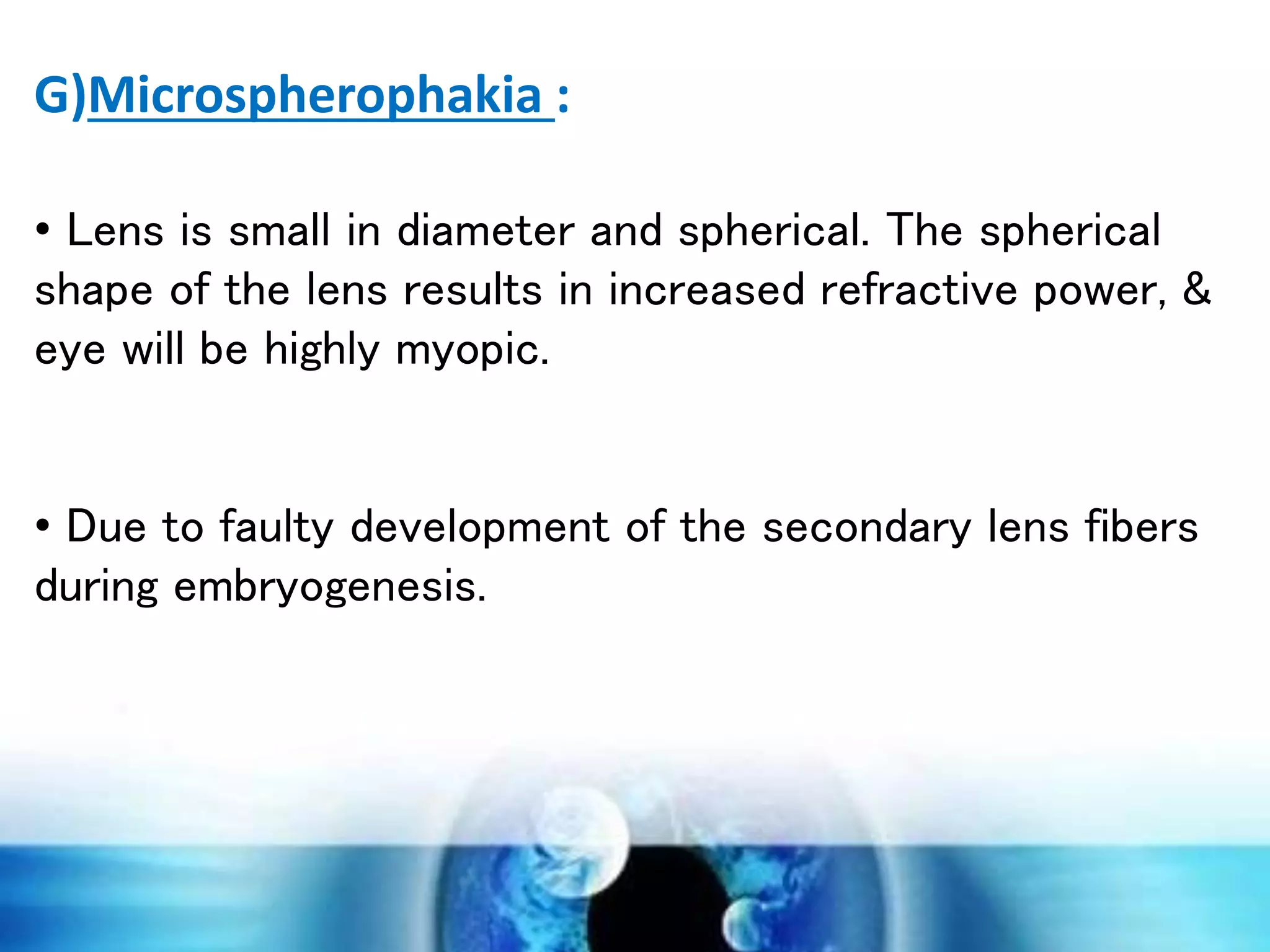 Embryology and developmental defects of lens | PPTX