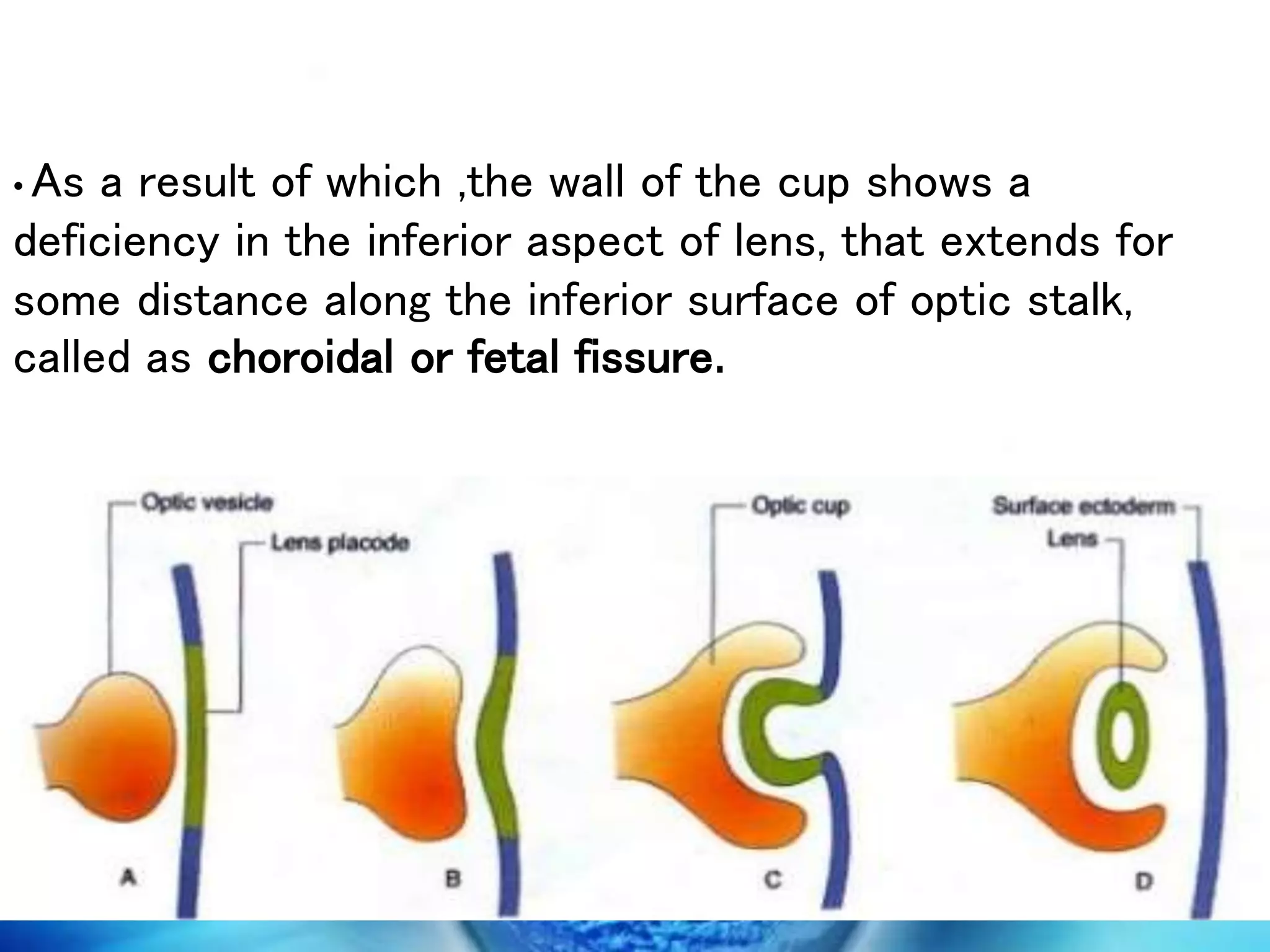 Embryology and developmental defects of lens | PPTX