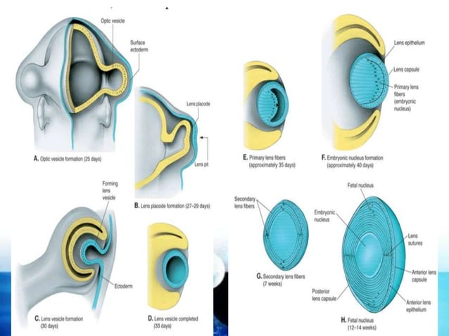Embryology and developmental defects of lens | PPTX | Eye and Vision ...