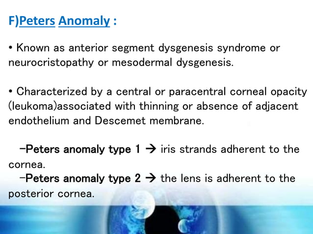 Embryology and developmental defects of lens | PPTX | Eye and Vision ...