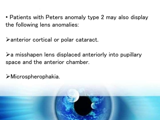 Embryology and developmental defects of lens | PPTX | Eye and Vision ...