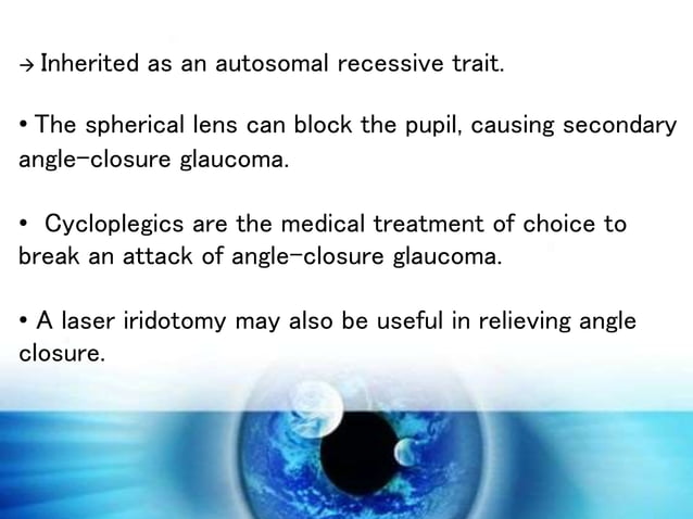 Embryology and developmental defects of lens | PPTX | Eye and Vision ...