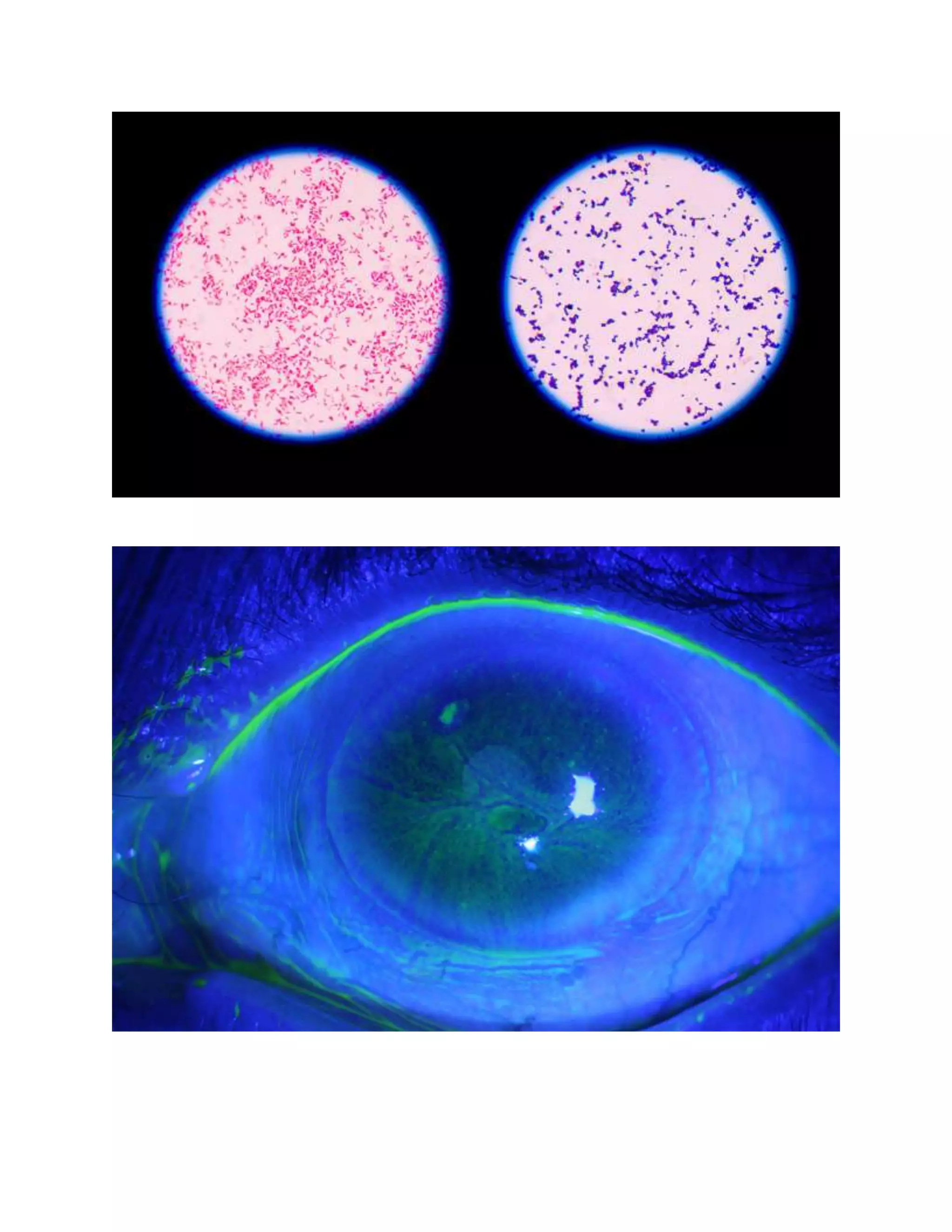 Ophtha report photos | DOCX