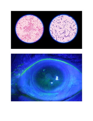 Ophtha report photos | DOCX