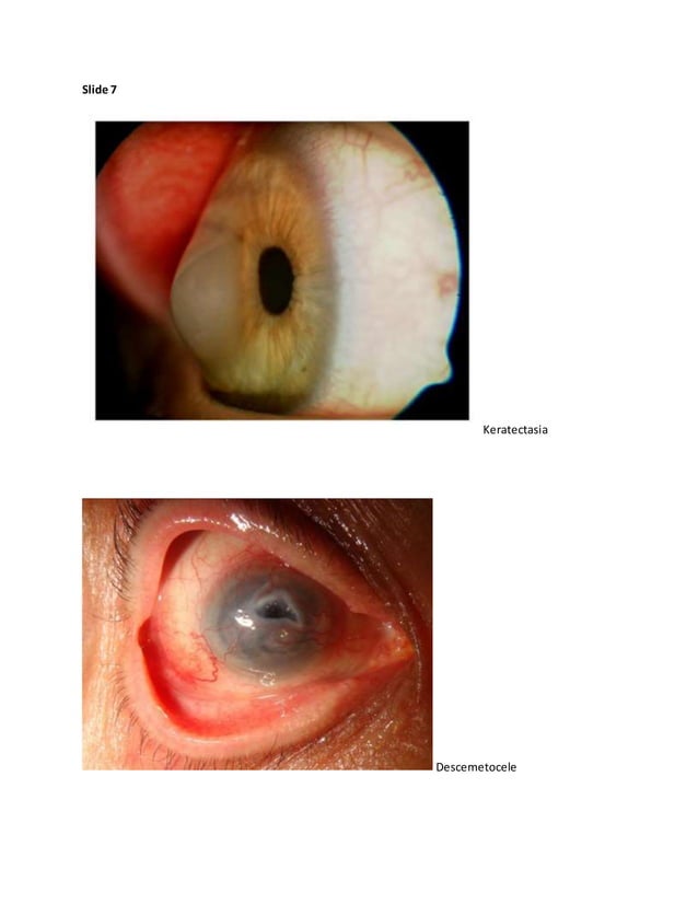 Ophtha report photos | PDF