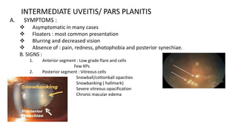Uveitis | PPTX