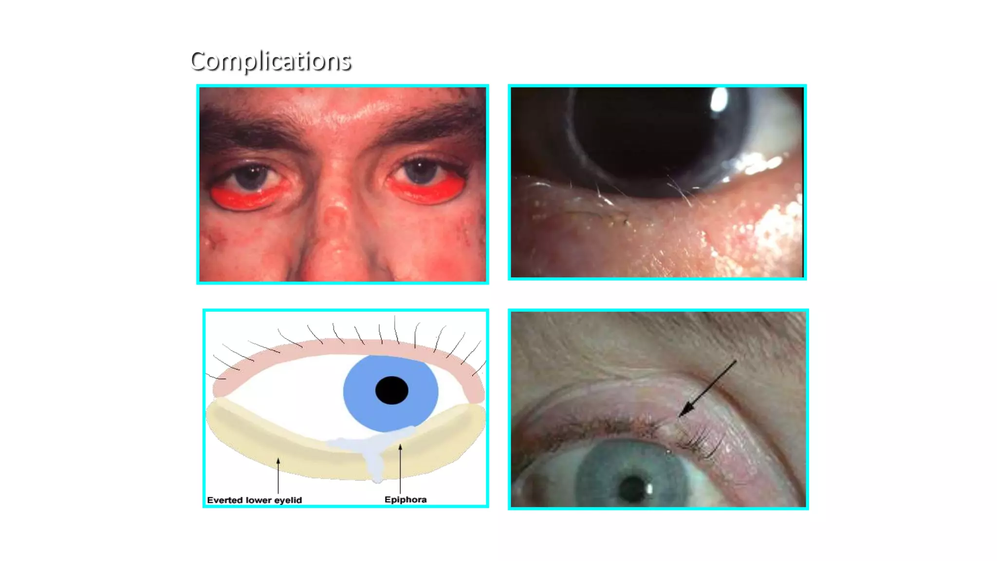 Ophth examination | PPT