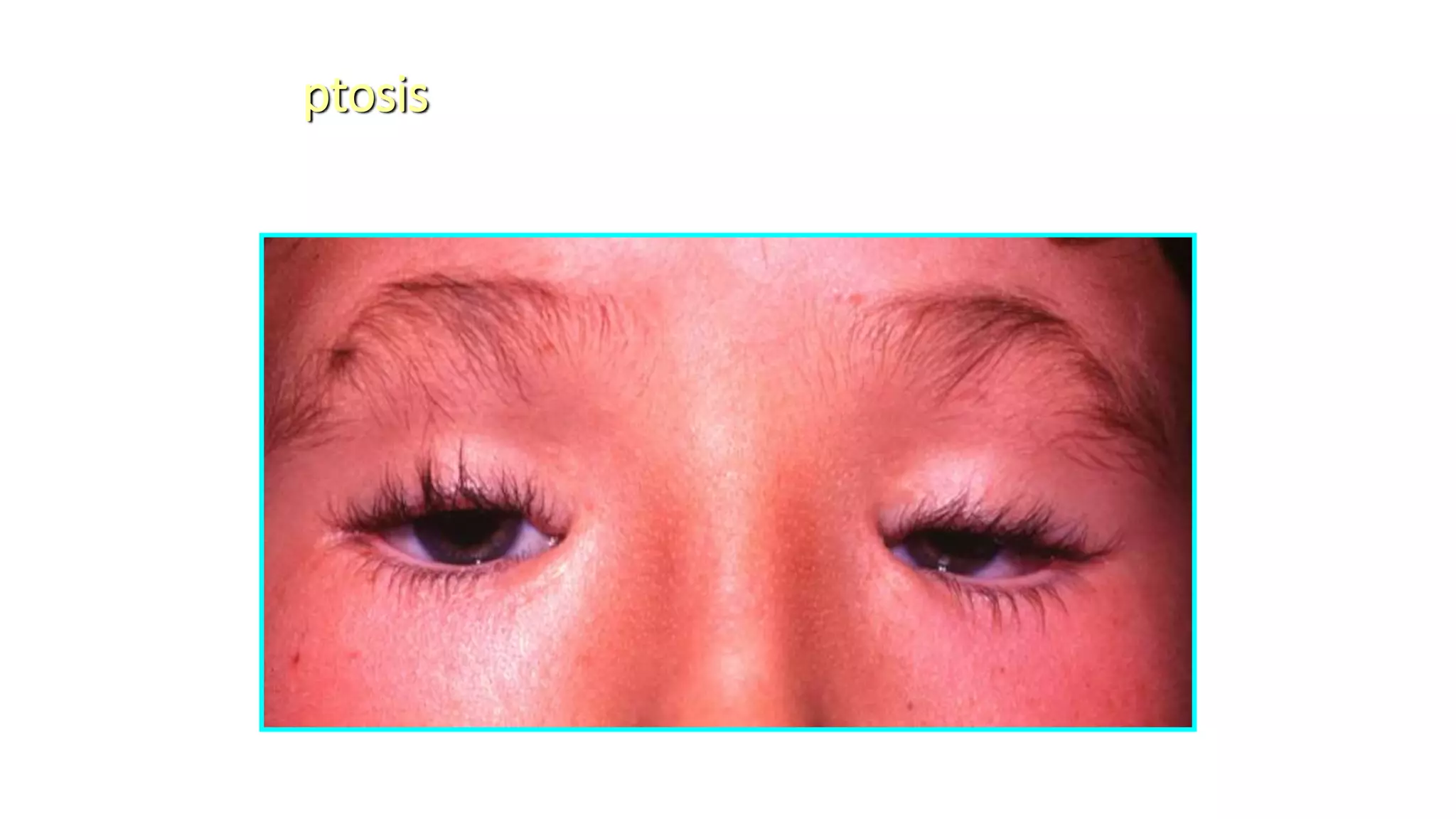 Ophth examination | PPT