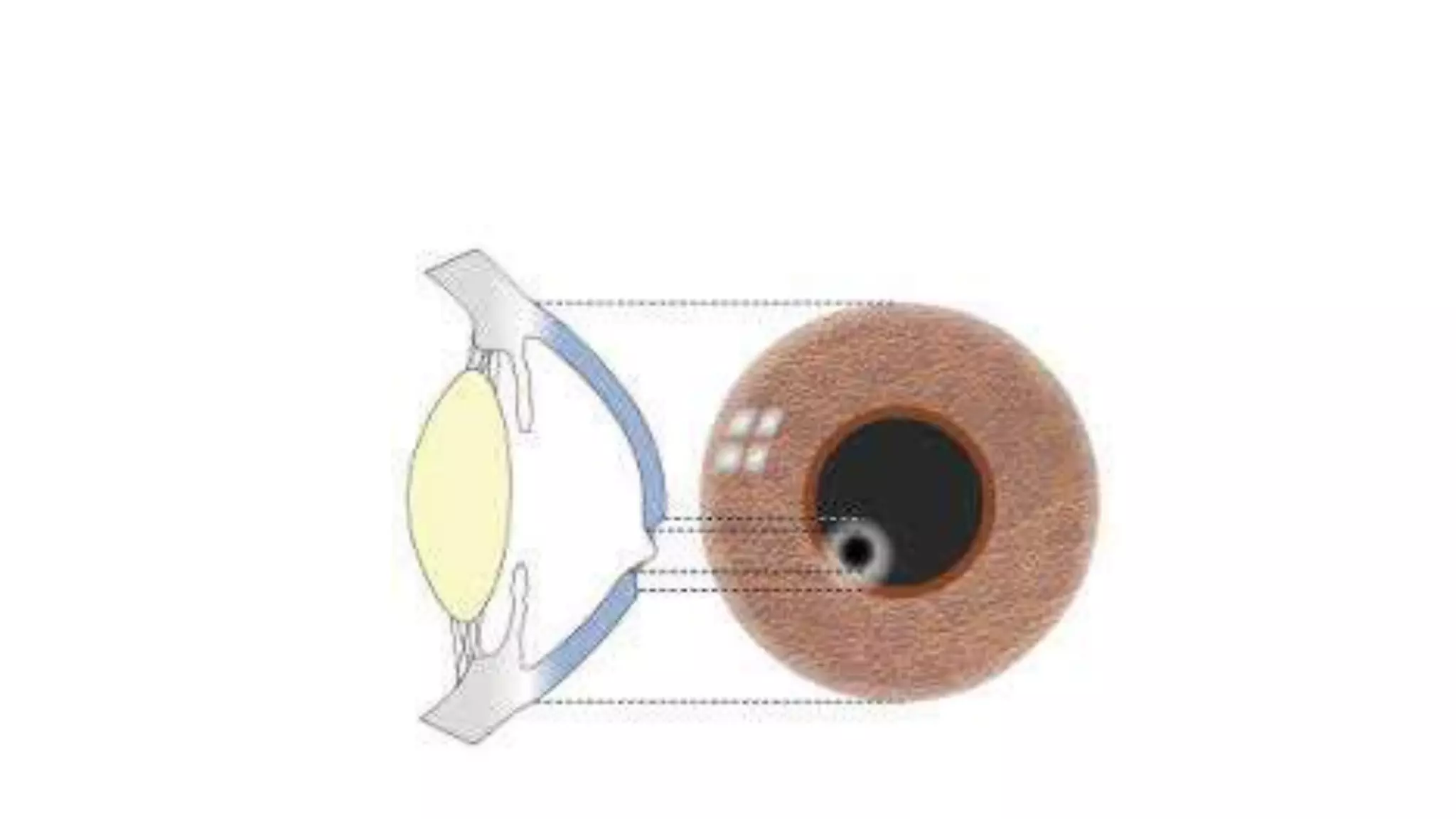 Ophth examination | PPT