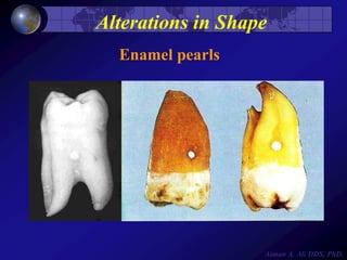 Opi 1-introduction-tooth abnormalities | PPTX