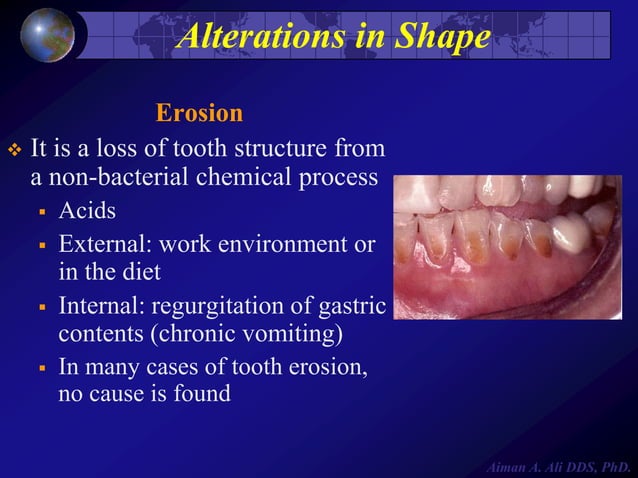 Opi 1-introduction-tooth abnormalities | PPT