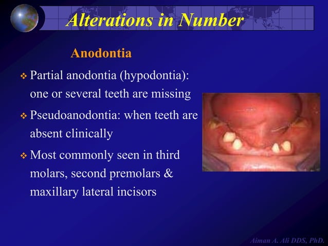 Opi 1-introduction-tooth abnormalities | PPT