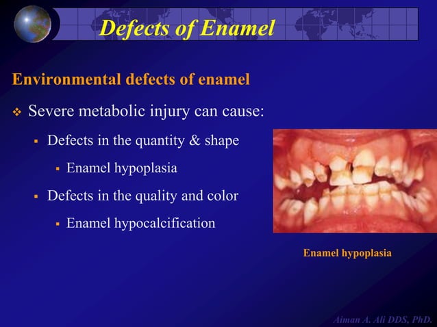Opi 1-introduction-tooth abnormalities | PPT