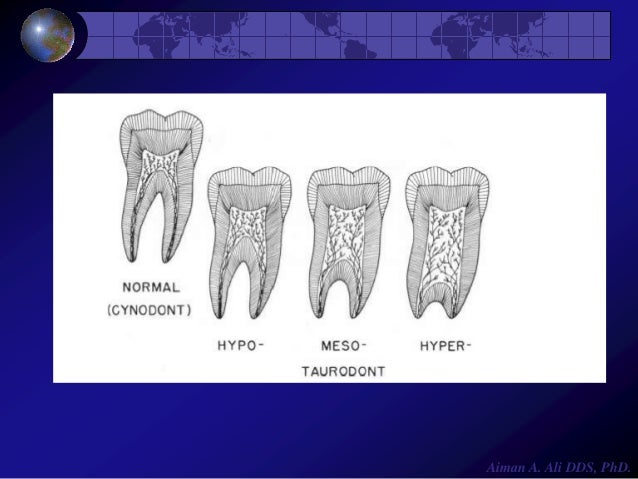 Opi 1-introduction-tooth abnormalities