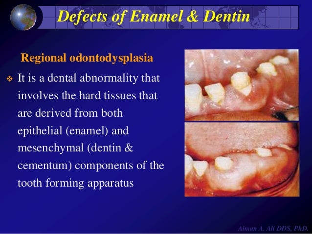 Opi 1-introduction-tooth abnormalities