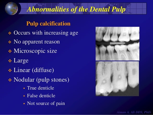 Opi 1-introduction-tooth abnormalities