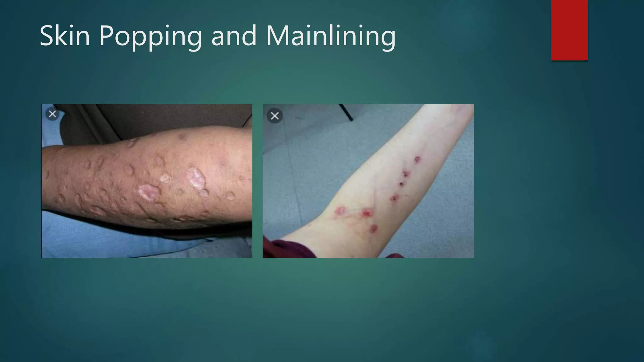 Opioid Toxicity.pptx