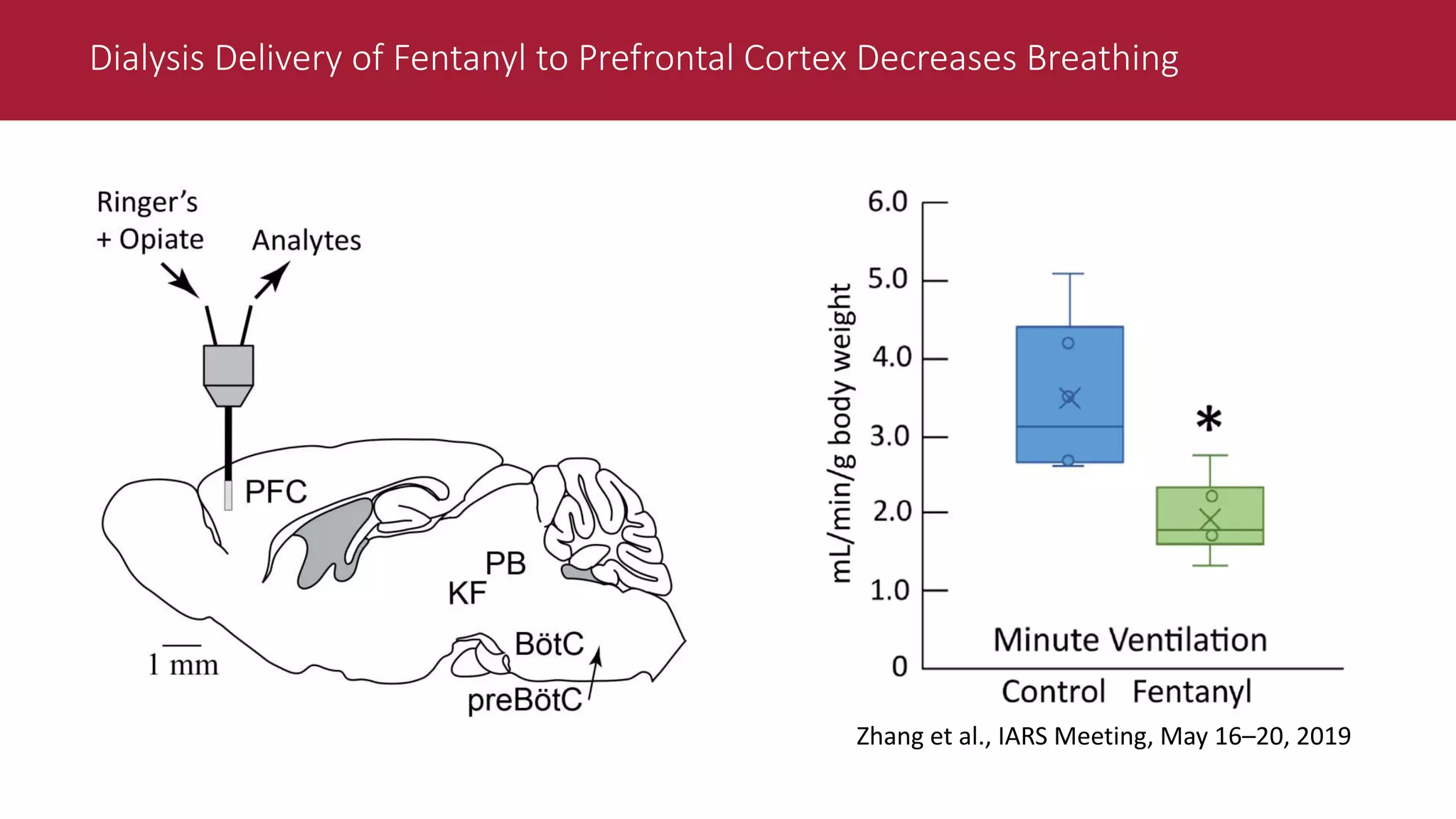 Understanding Physiological Mechanisms of Opioid Addiction ...