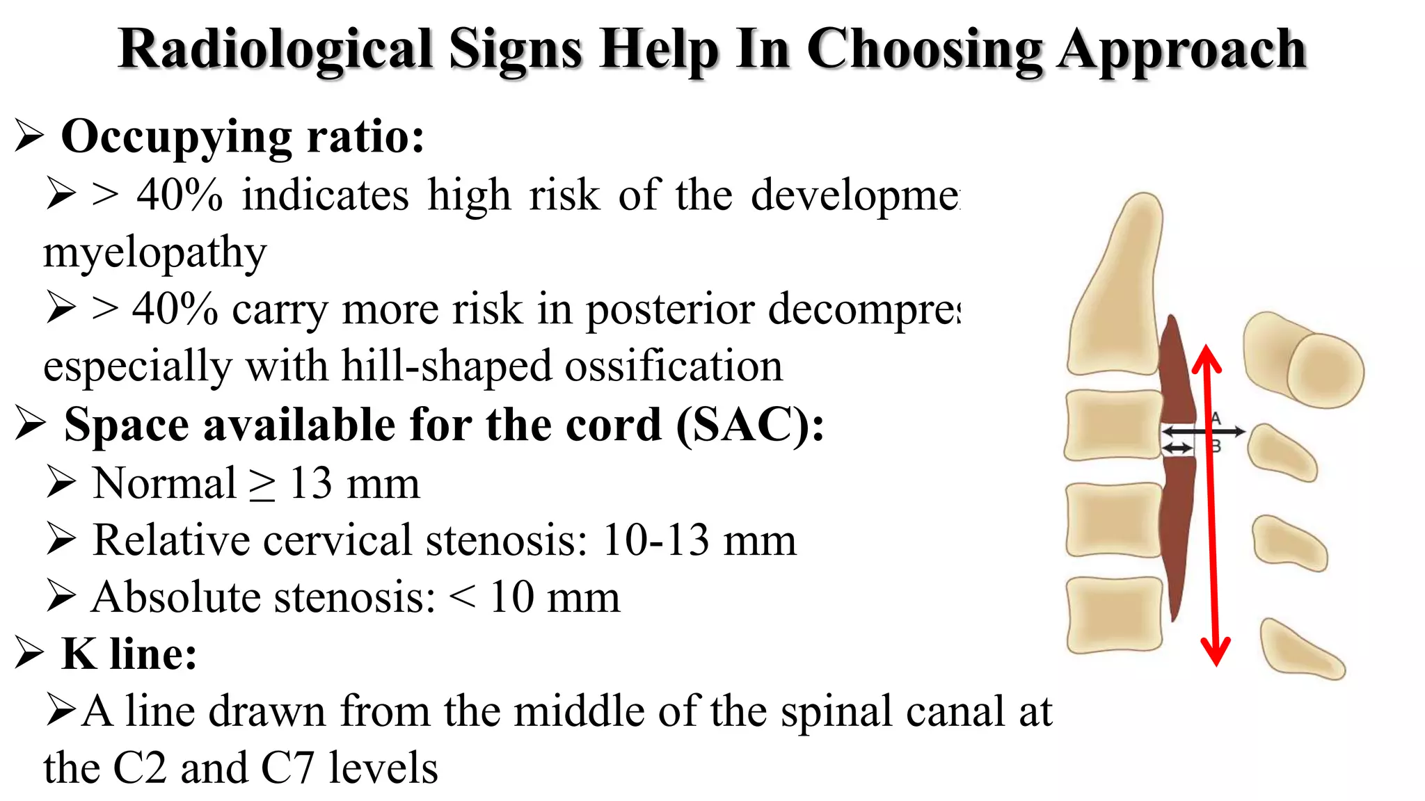 Ossified Posterior Longitudinal Ligament (OPLL) | PPTX | Bone and Joint ...