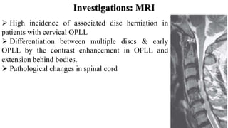 Ossified Posterior Longitudinal Ligament (OPLL) | PPTX | Bone and Joint ...