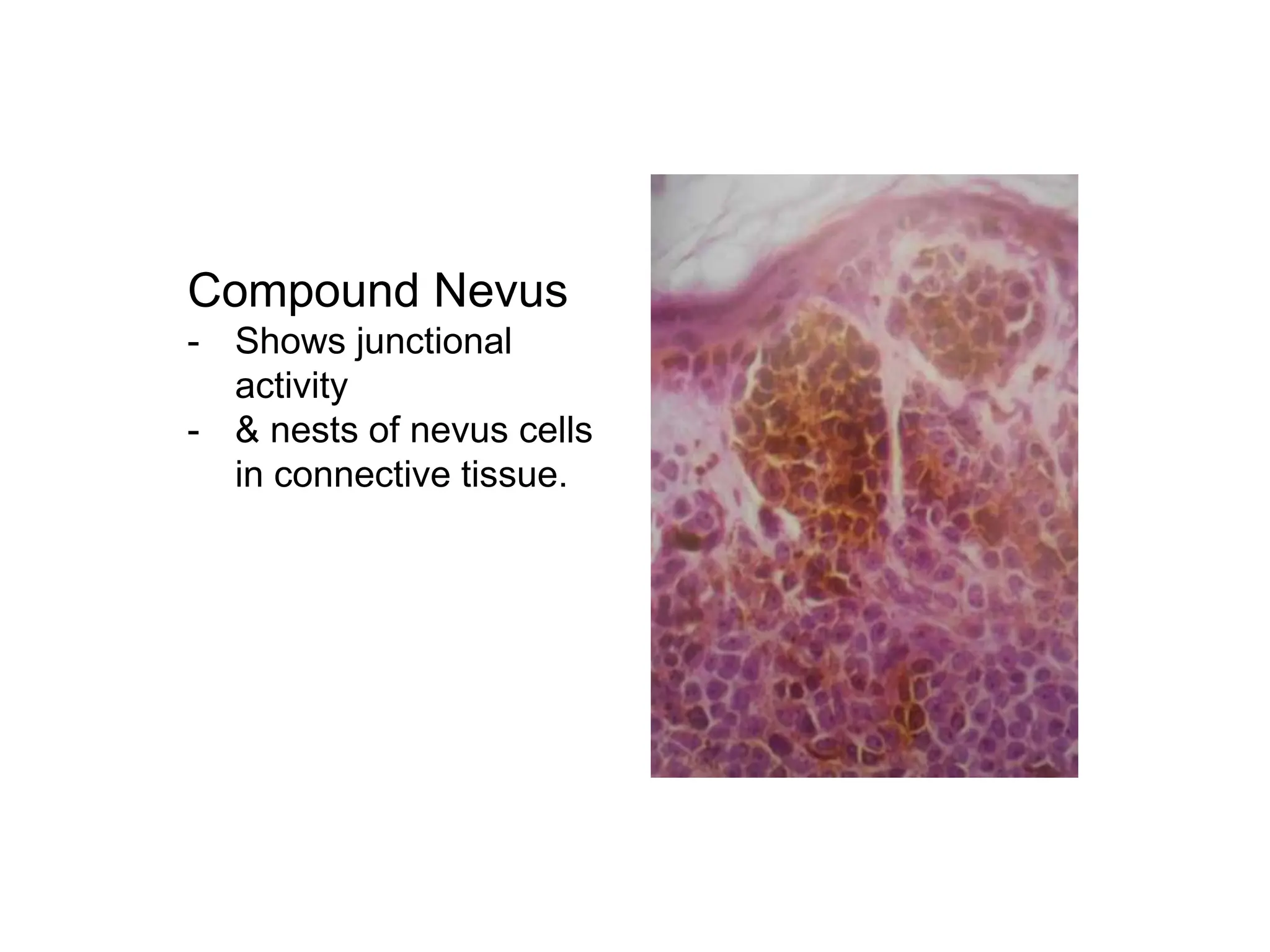 OPM-Benign_Tumors_Epitlelial_Origin-16-12-14.ppt