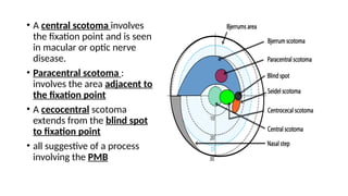 optic nerve anatomy physiology and pathophysiology | PPTX