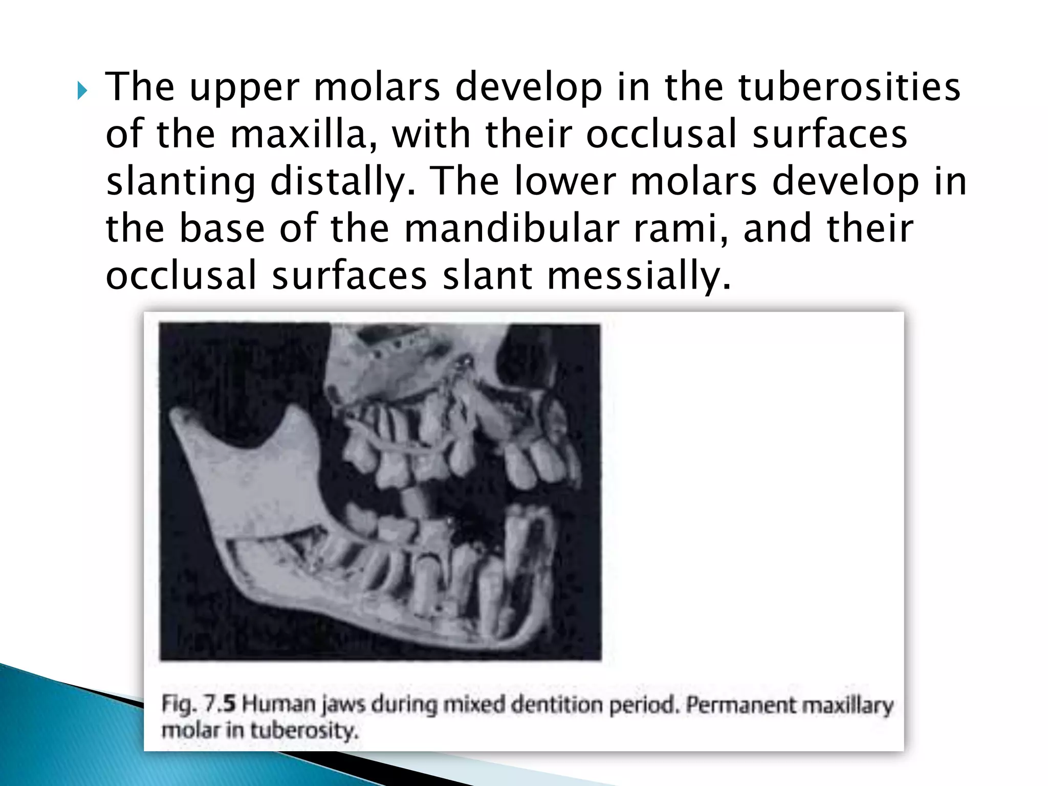Mechanisms of Tooth Eruption & Mammalian Teeth 3 Categories on the ...