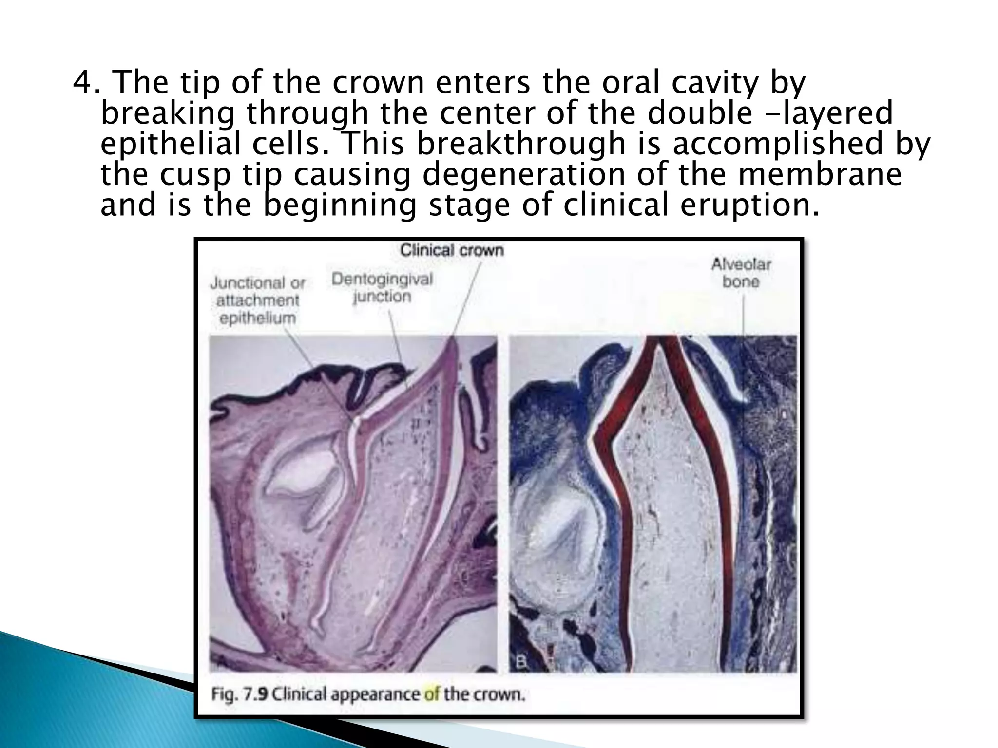 Mechanisms of Tooth Eruption & Mammalian Teeth 3 Categories on the ...