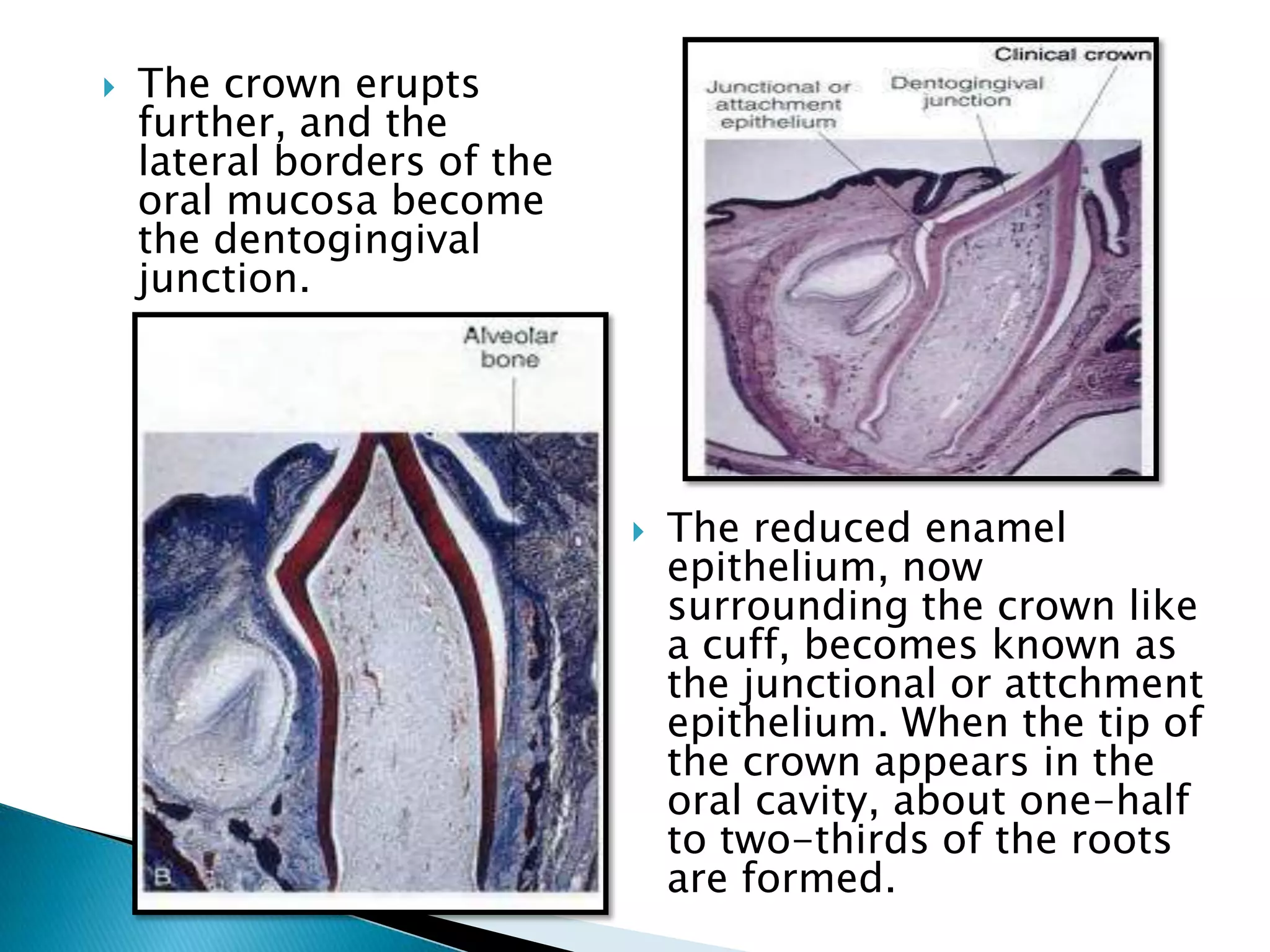 Mechanisms of Tooth Eruption & Mammalian Teeth 3 Categories on the ...