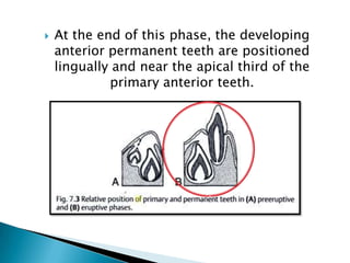 Mechanisms of Tooth Eruption & Mammalian Teeth 3 Categories on the ...