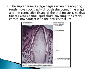 Mechanisms of Tooth Eruption & Mammalian Teeth 3 Categories on the ...