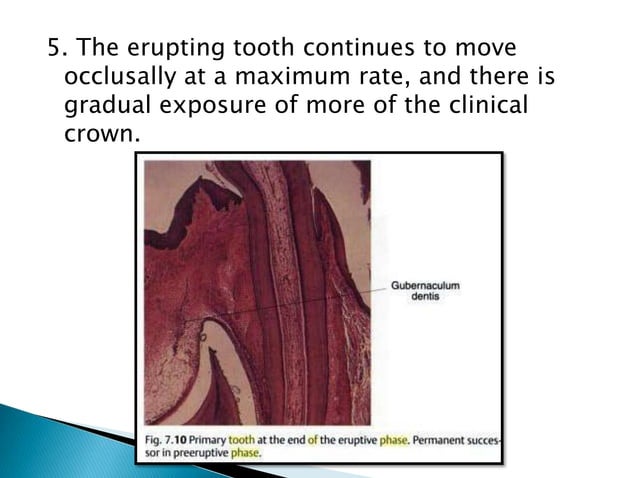 Mechanisms of Tooth Eruption & Mammalian Teeth 3 Categories on the ...
