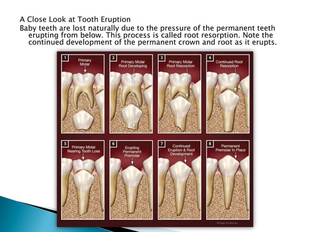 Mechanisms of Tooth Eruption & Mammalian Teeth 3 Categories on the ...