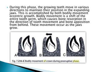 Mechanisms of Tooth Eruption & Mammalian Teeth 3 Categories on the ...