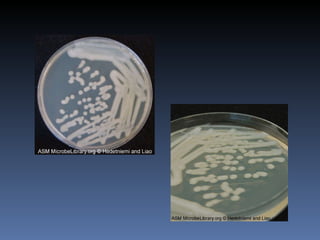 Klebsiella Pneumoniae Nutrient Agar