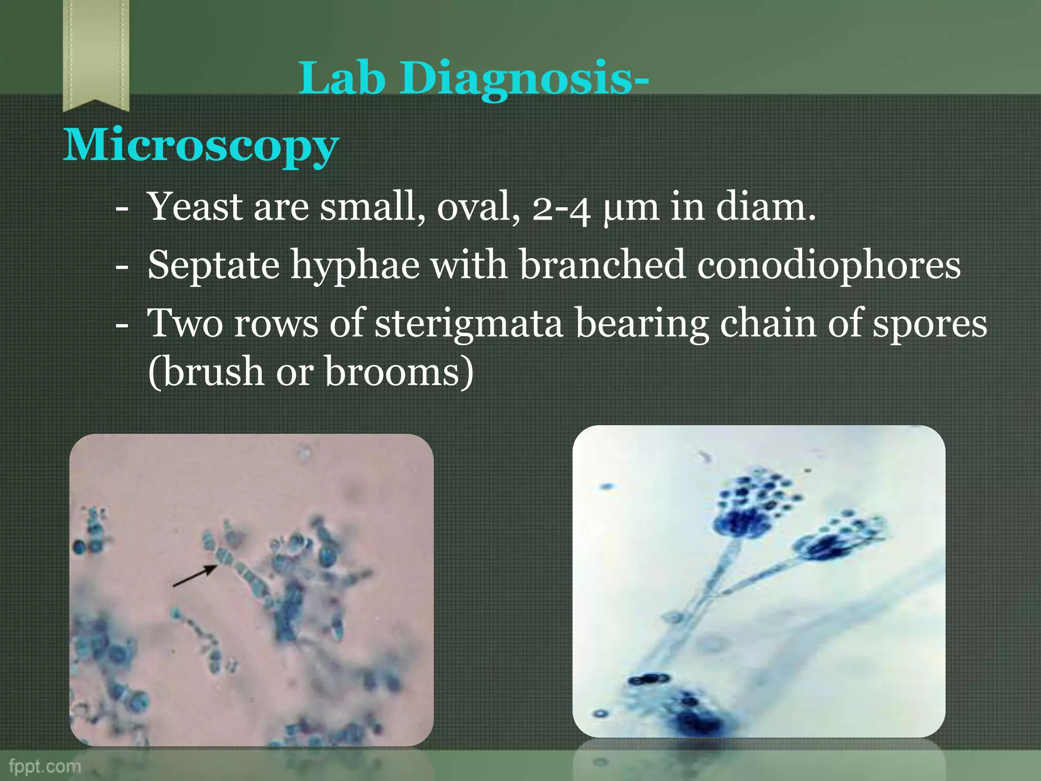 Opportunistic fungal infection | PPTX