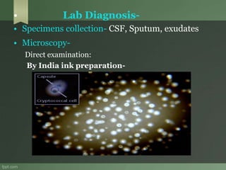 Opportunistic fungal infection | PPTX
