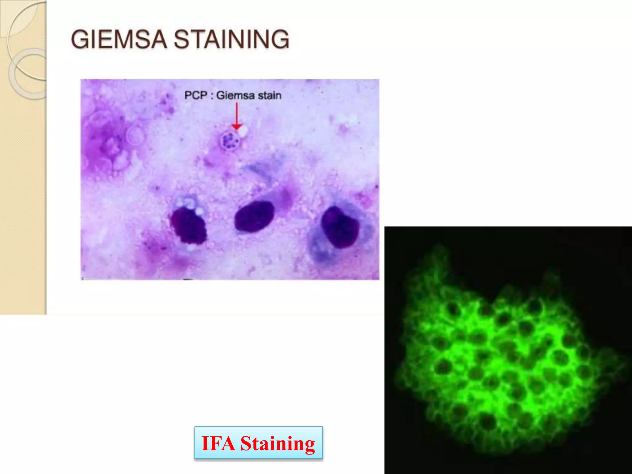 Opportunistic fungal infections | PPTX