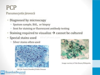 Opportunistic Fungal Infections atf.pdfnn | PDF