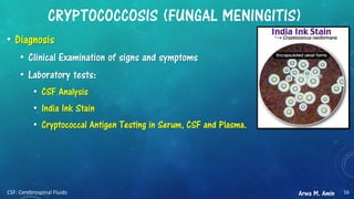 Opportunistic Infections in HIV | PDF