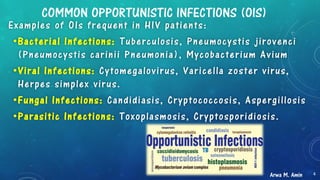 Opportunistic Infections in HIV | PDF