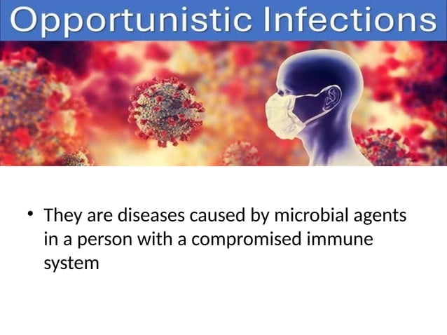 Common opportunistic infections in HIV.pptx