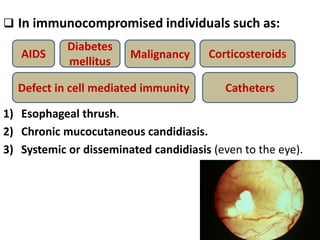 Opportunistic mycoses cadidiasis | PPTX