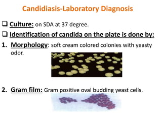 Opportunistic mycoses cadidiasis | PPTX