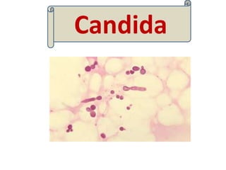 Opportunistic mycoses cadidiasis | PPTX