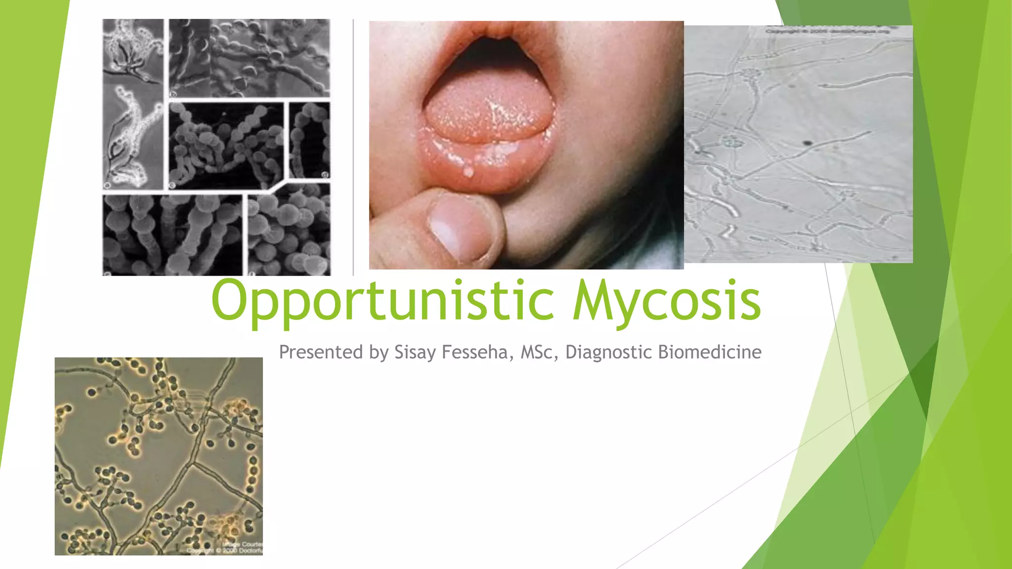 Opportunistic Mycosis.pdf