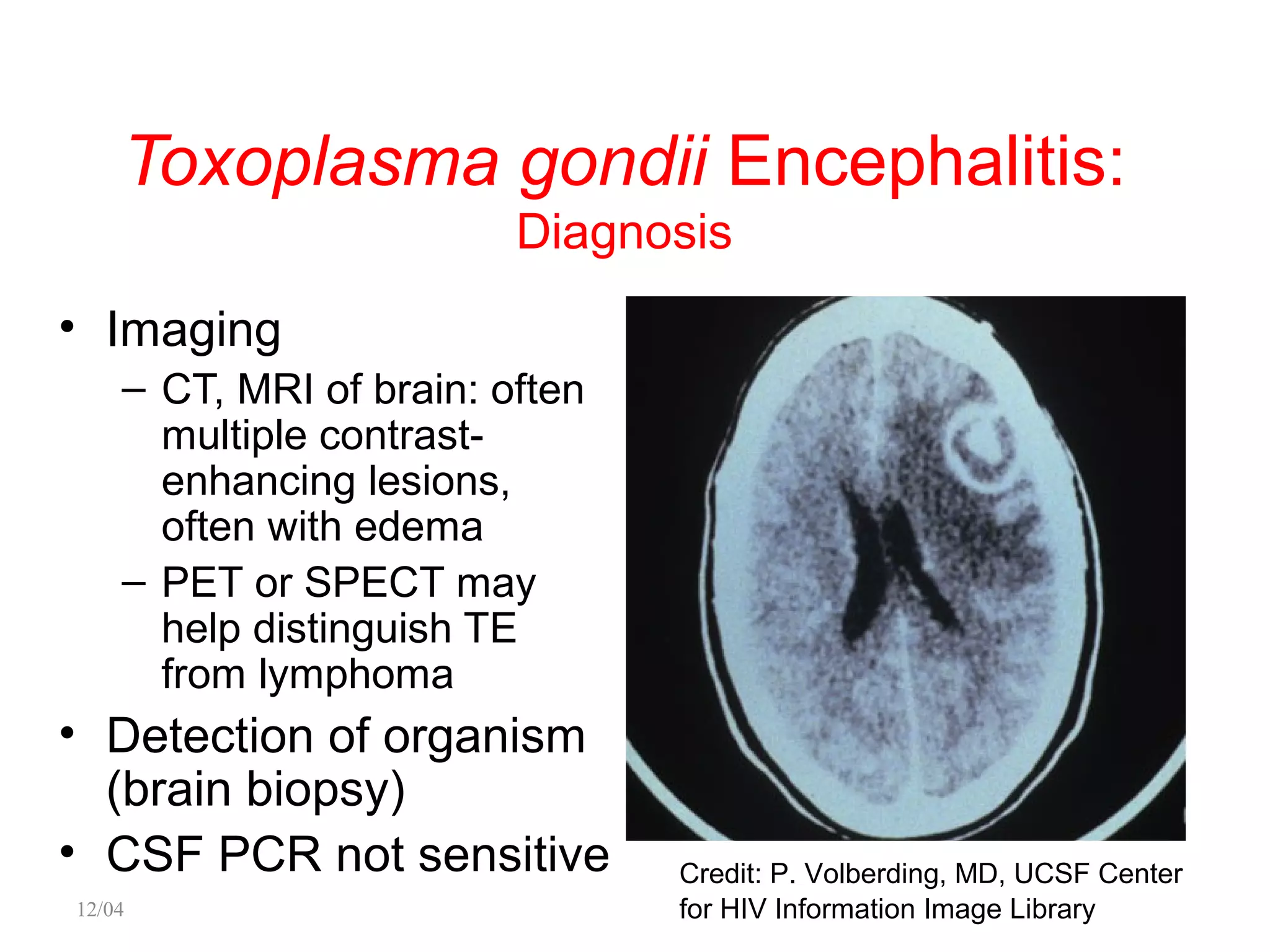 Opportunistic parasitic infections | PPT
