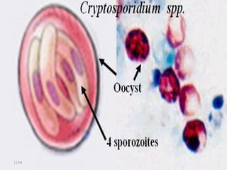 Opportunistic parasitic infections | PPT