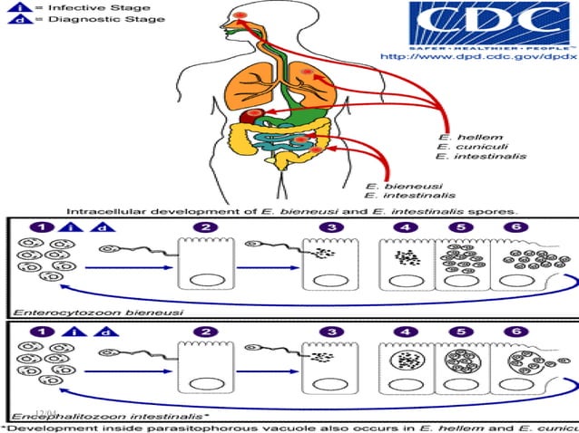 Opportunistic parasitic infections | PPT | Digestive Disorders ...