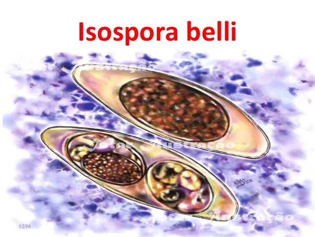 Opportunistic parasitic infections